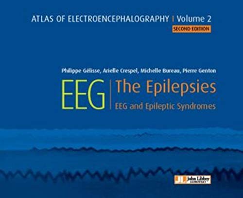 Atlas of electroencephalography: The Epilepsies. EEG and epileptic ...