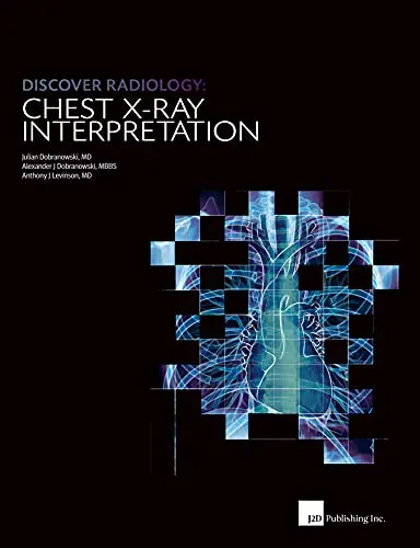 Discover Radiology Chest X-Ray Interpretation : Book for Medical ...