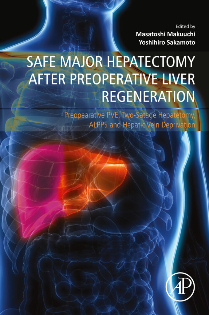 Safe Major Hepatectomy after Preoperative Liver Regeneration ...