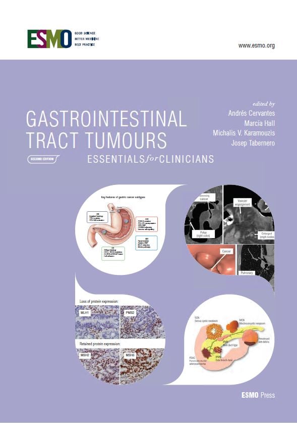 ESMO Gastrointestinal Tract Tumours: Essentials for Clinicians, 2nd ...