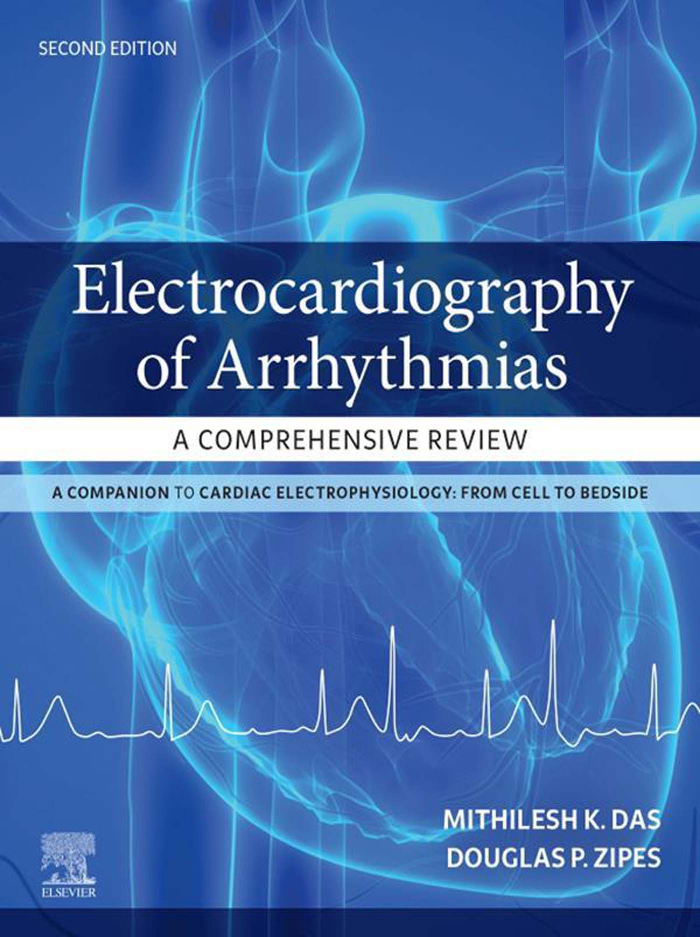 Electrocardiography of Arrhythmias: A Comprehensive Review: A Companion ...