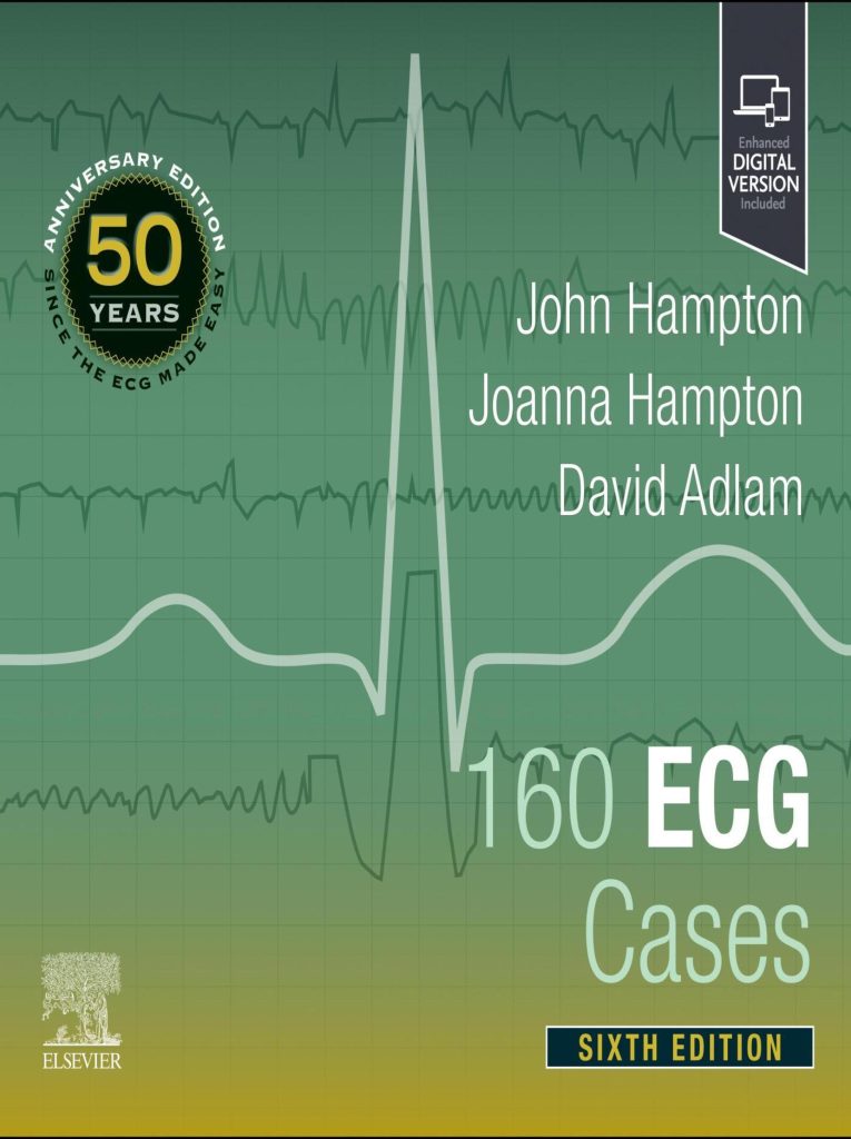 160 ECG Cases, 6th Edition (Original PDF from Publisher) - Afkebooks ...