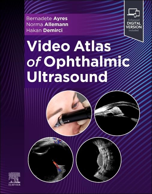 Video Atlas of Ophthalmic Ultrasound (True PDF) - Afkebooks - Medical ...